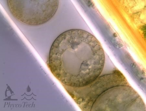 Appendix A. Visual Guide to Common Harmful Cyanobacteria – HCB-1