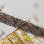 Appendix A. Visual Guide to Common Harmful Cyanobacteria – HCB-1