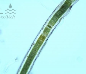 Appendix A. Visual Guide to Common Harmful Cyanobacteria – HCB-1