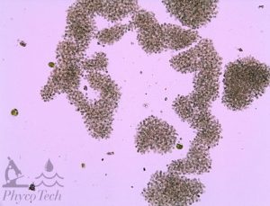 Appendix A. Visual Guide to Common Harmful Cyanobacteria – HCB-1