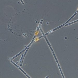 Appendix A. Visual Guide to Common Harmful Cyanobacteria – HCB-1