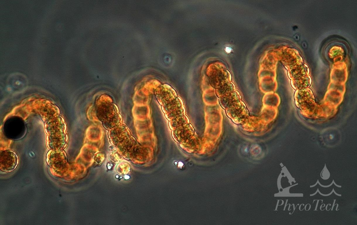 Appendix A. Visual Guide to Common Harmful Cyanobacteria – hcb