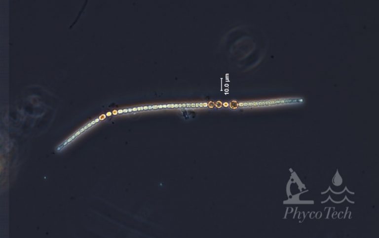 Appendix A. Visual Guide to Common Harmful Cyanobacteria – hcb
