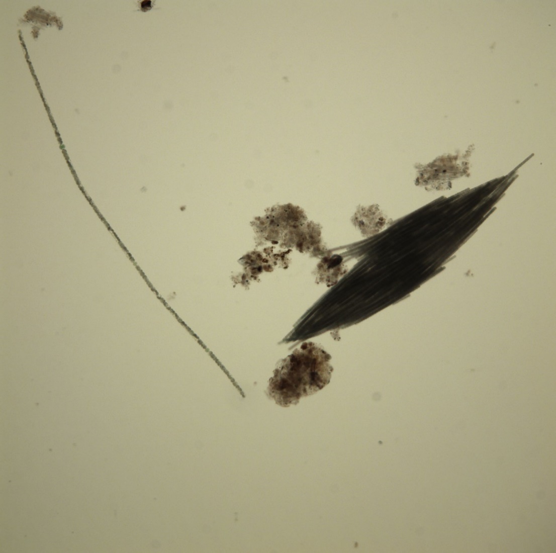 Appendix A. Visual Guide to Common Harmful Cyanobacteria – hcb